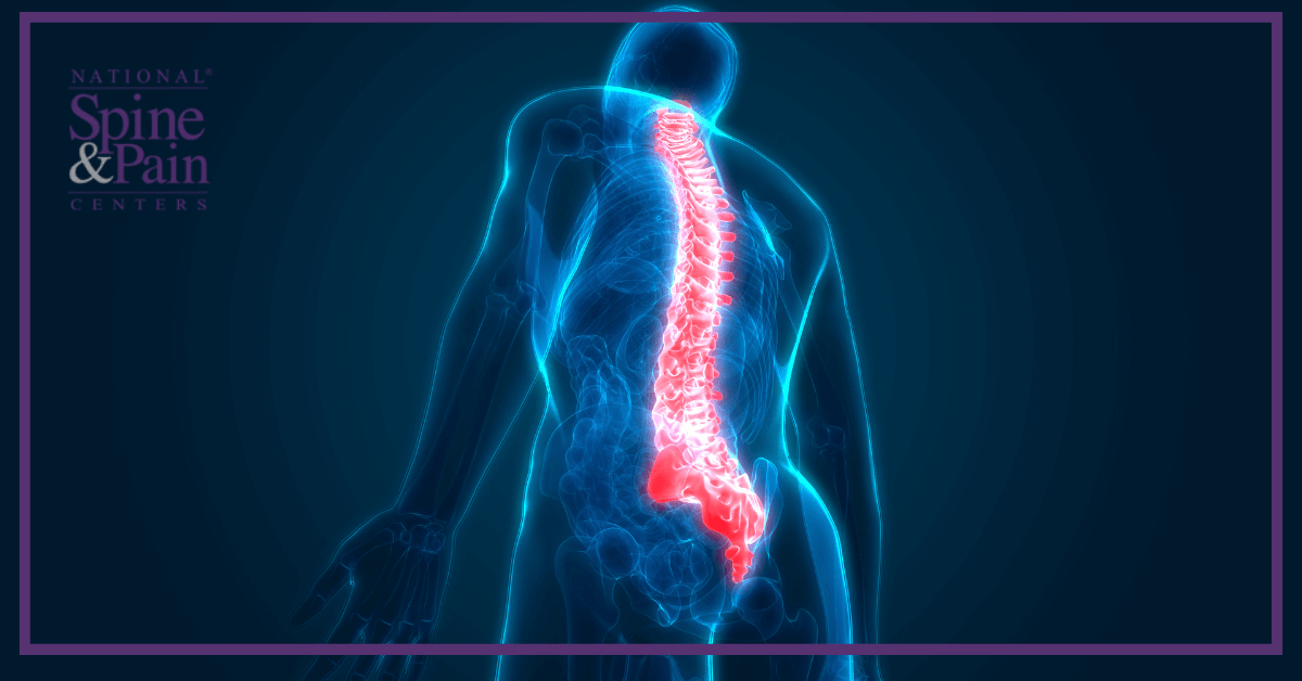 Middle and Upper (Thoracic) Back Pain