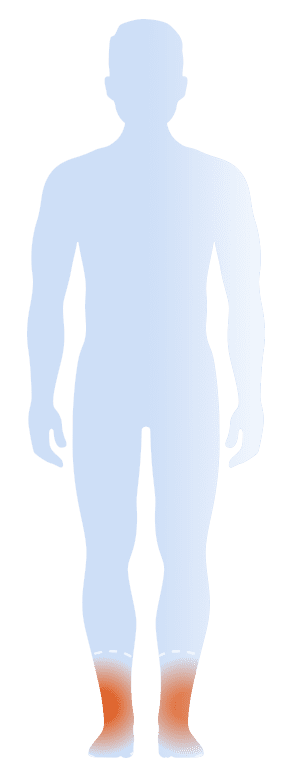 Benefits of epidural steroid injections for back and leg pain