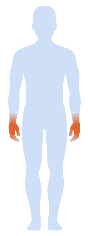 Timothy D. Replogle II MD