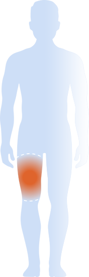 Timothy D. Replogle II MD