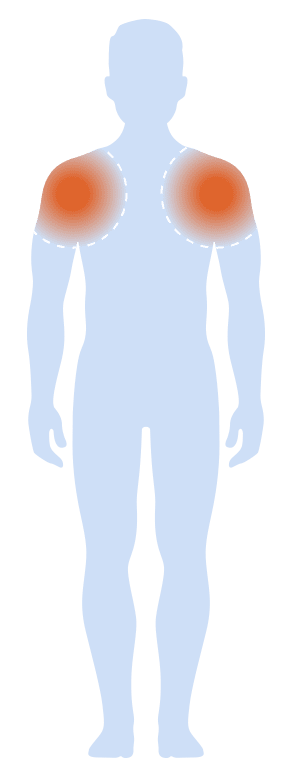 Timothy D. Replogle II MD