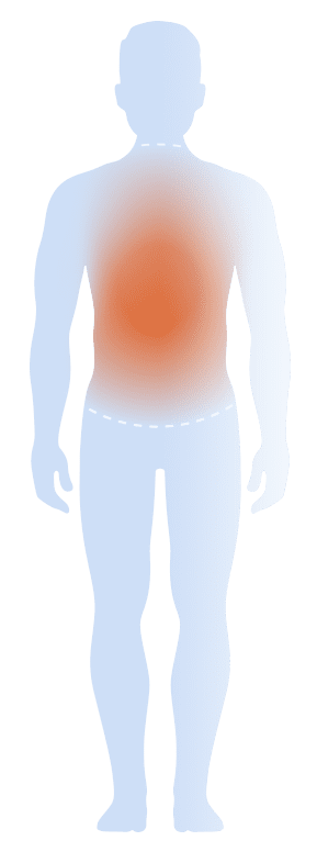 Timothy D. Replogle II MD