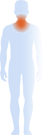 Timothy D. Replogle II MD